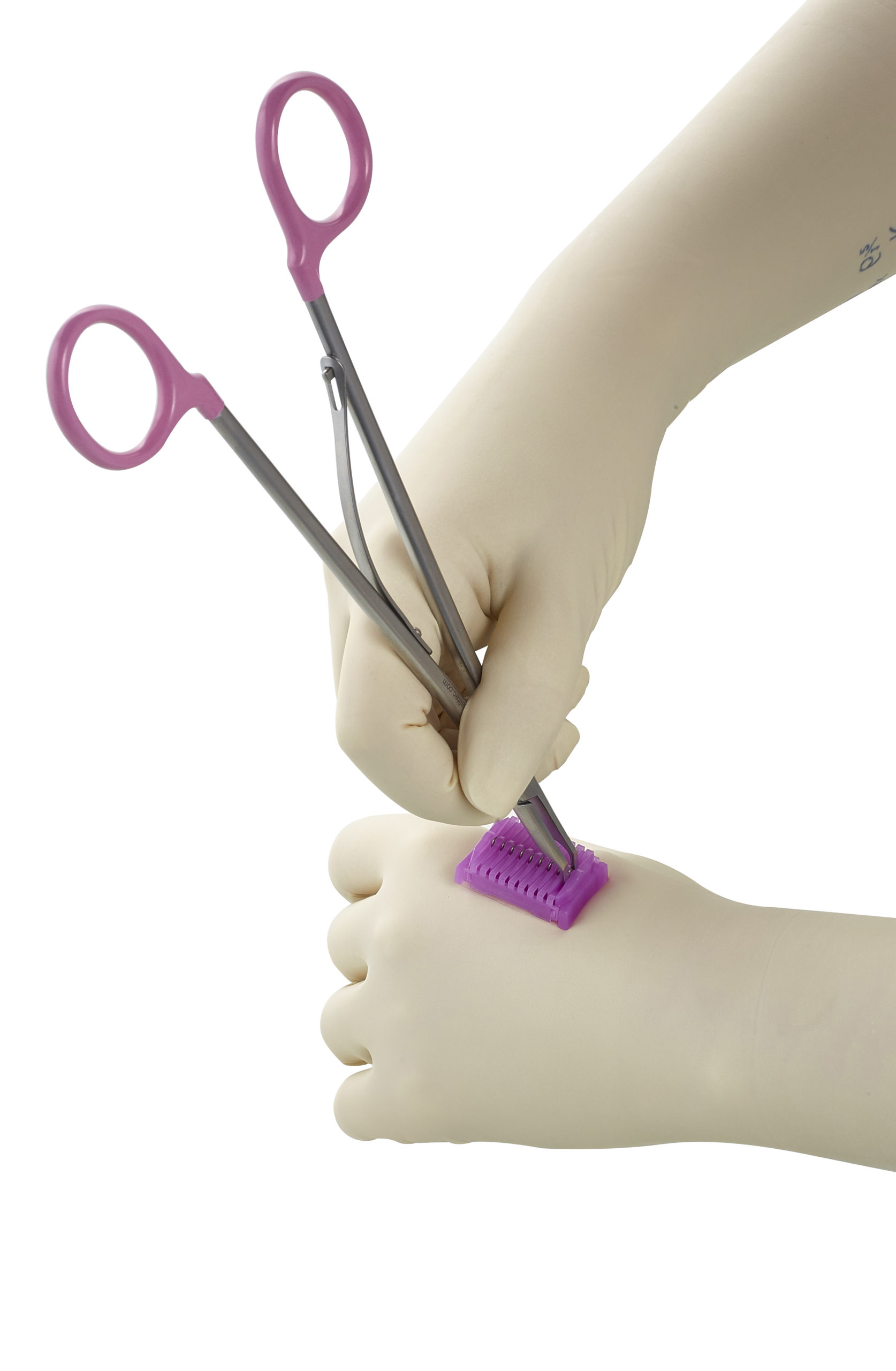 Titanium Hemostatic Clips during Coronary Bypass Procedure - Peters ...